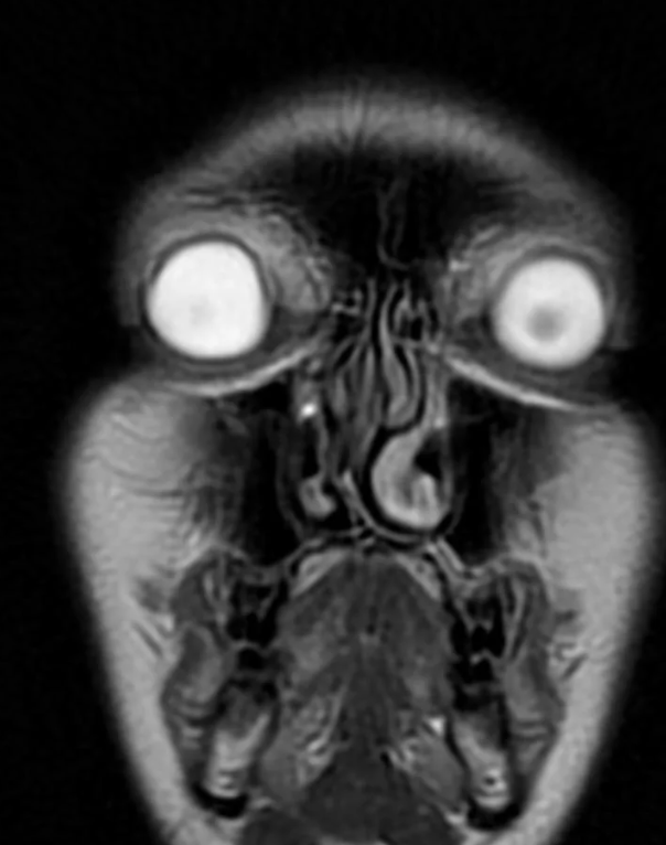 Photos of 'Normal' Things That Look Unexpectedly Scary | eBaum's World