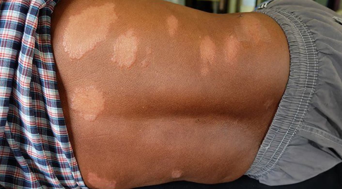 25 Creepy Facts to Make Your Skin Crawl | eBaum's World