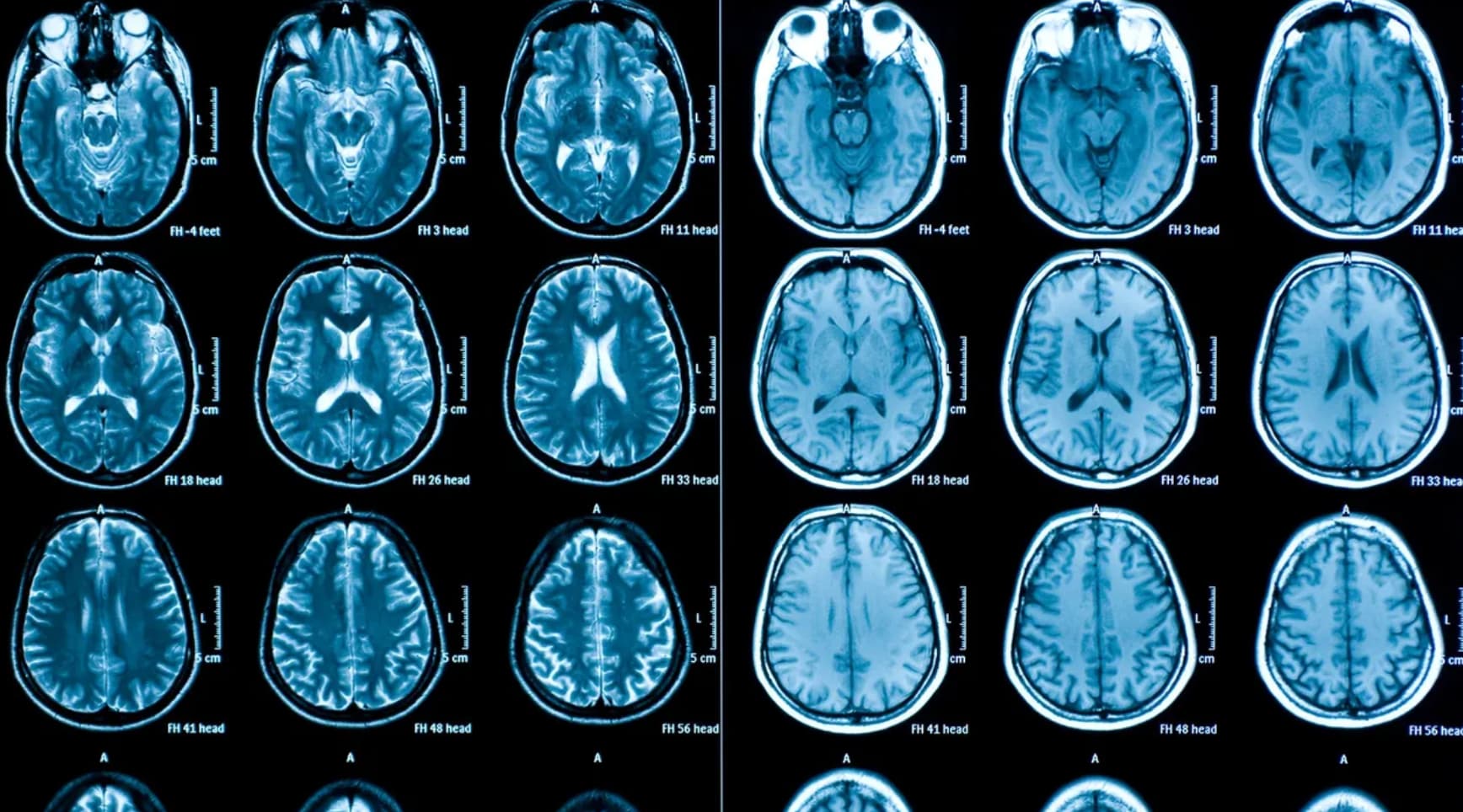 Fun Facts About the Organ That Named Itself: The Brain | eBaum's World
