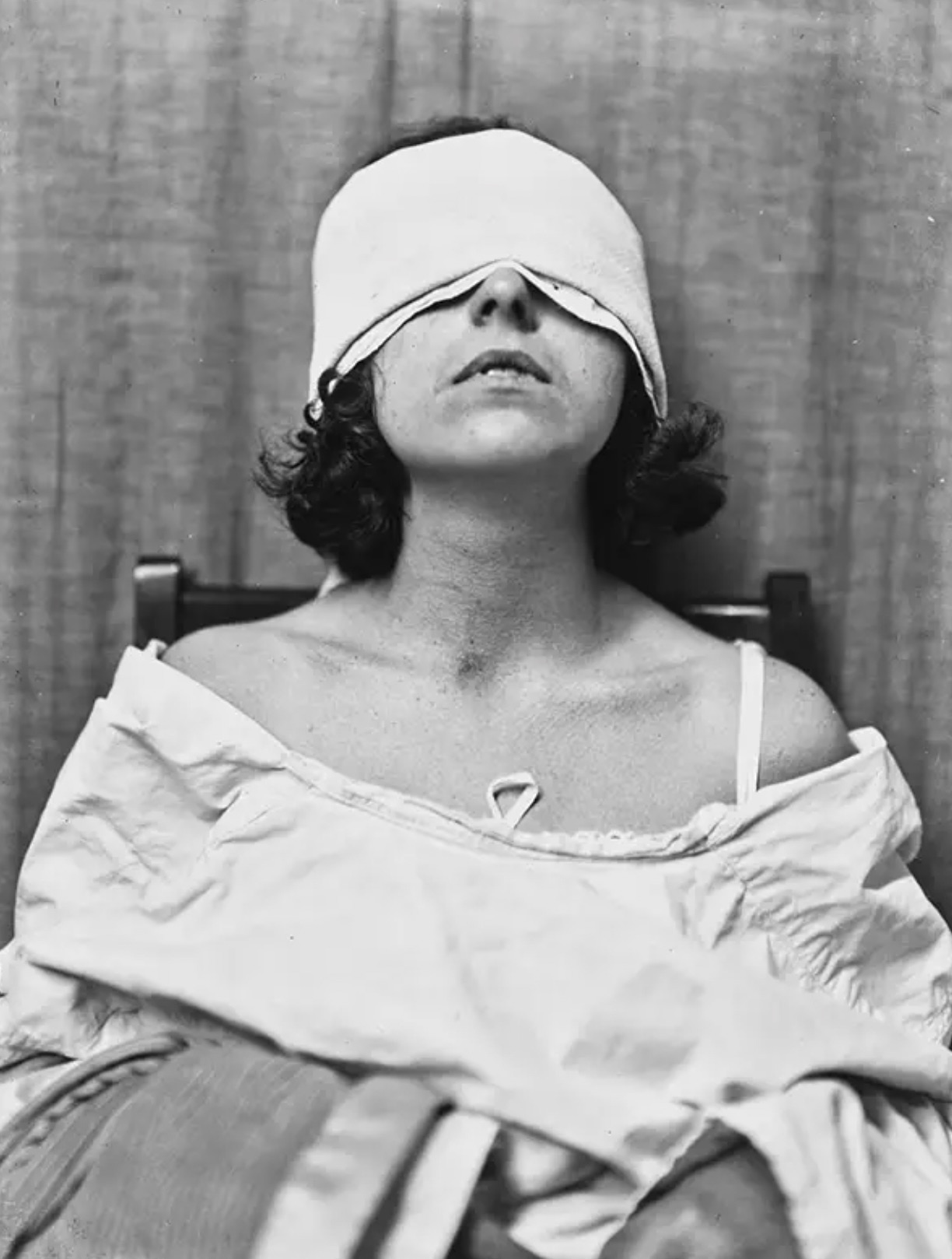 Vintage Brain Surgery Patients, Before Modern Medicine | eBaum's World
