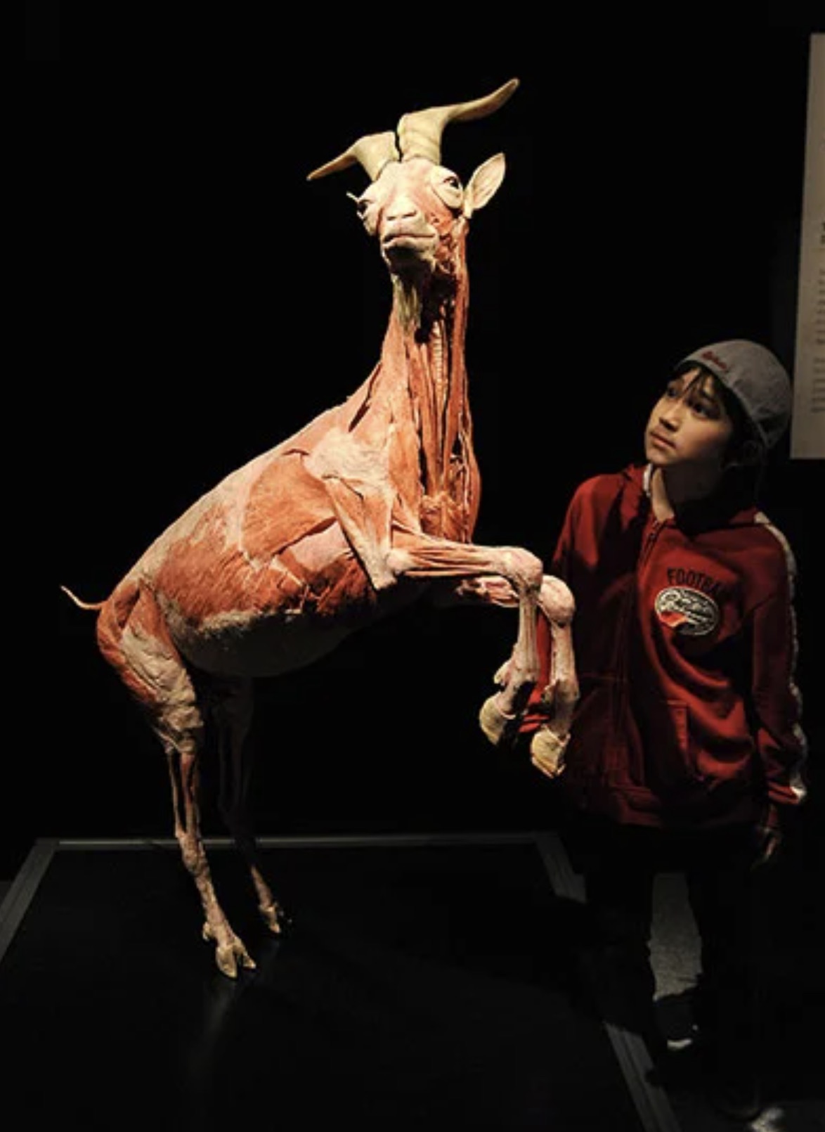 50 Terrifying Inside-Out Anatomy Statues | eBaum's World