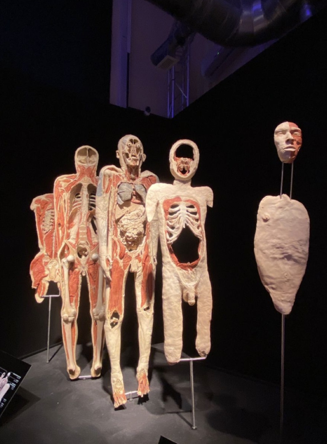 50 Terrifying Inside-Out Anatomy Statues | eBaum's World