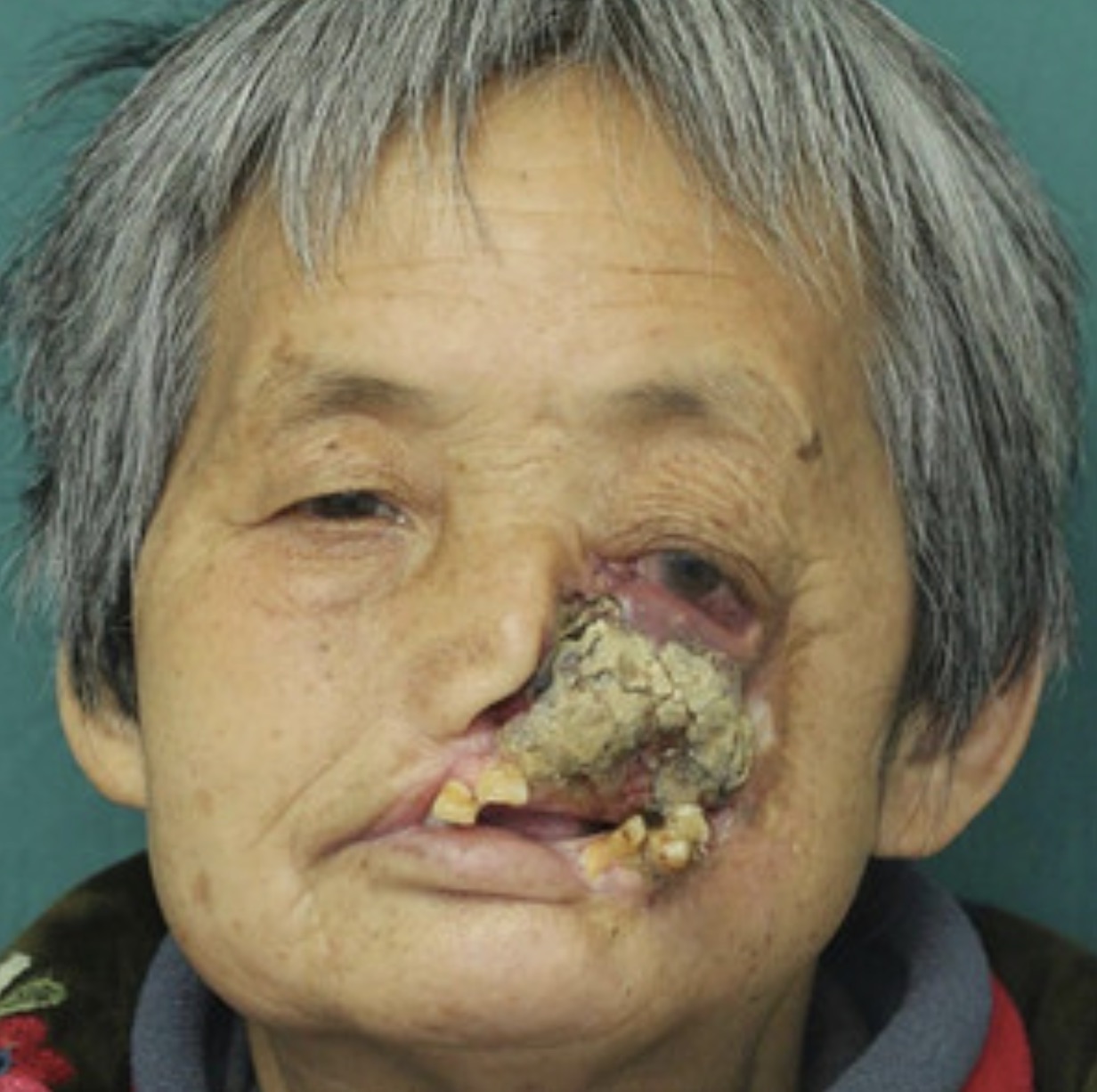 15 Syndromes You Don't Want to Google (WARNING: GRAPHIC) | eBaum's World