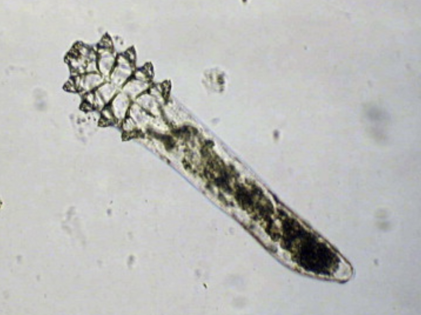 Pics of the Microscopic Beings Living On and Among Us | eBaum's World