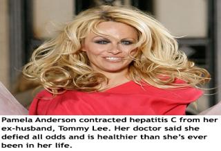 15 Celebrities With STDs - Gross Gallery | eBaum's World