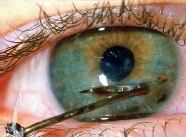 18 Photos That Make You Scream NOPE At The Top of Your Lungs - Eww ...