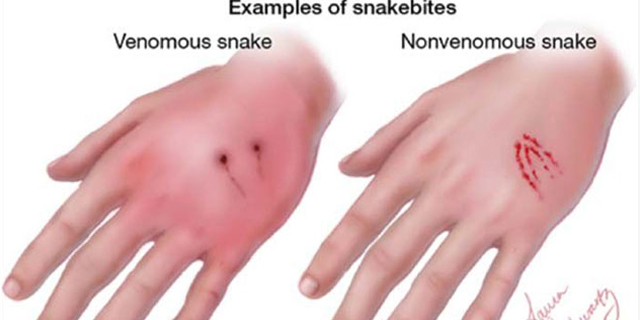 A Definitive Guide To Deadly And Non-deadly Snakes - Ftw Gallery ...