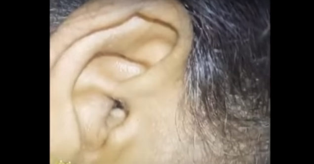 Woman Has a Spider Living in Her Ear - Wow Video | eBaum's World