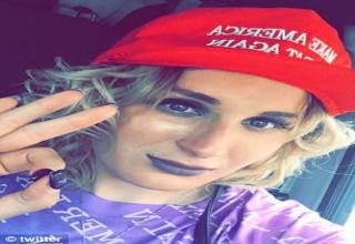 Pictures of Laura Loomer Before and After The Nose Job - Funny Gallery ...