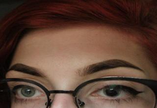 26 People Who Have Odd and Unique Body Features - Ftw Gallery | eBaum's ...