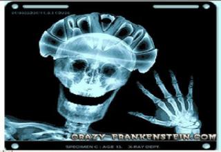 funny xrays - Gallery | eBaum's World