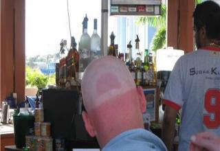 26 Embarrassing Tan Line Fails | eBaum's World