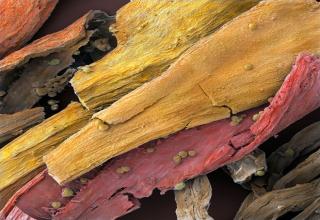 Food Under The Microscope - Gallery | eBaum's World