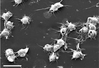 18 Weird Microscopic Photos of The Human Body - Creepy Gallery | eBaum ...