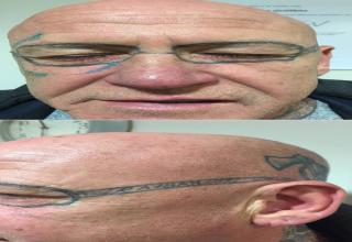 10 of The Worst Drunken Tattoo Stories - Wow Gallery | eBaum's World