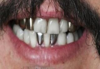 Which famous celeb do these horrible teeth belong to? - Eww Gallery ...