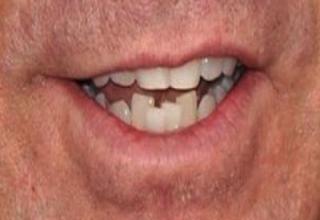 Which famous celeb do these horrible teeth belong to? - Eww Gallery ...