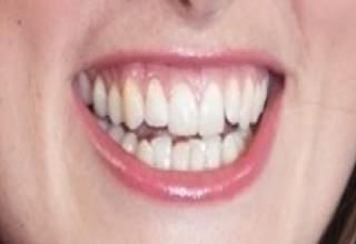 Which famous celeb do these horrible teeth belong to? - Eww Gallery ...