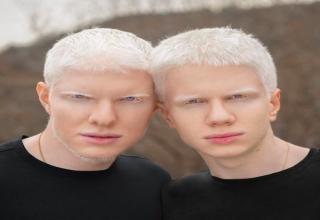 18 Genetic Anomalies That are Rare and Unique - Wow Gallery | eBaum's World