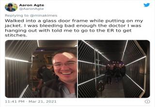 24 Stupid Injuries People Wish They Had Avoided - Funny Gallery | eBaum ...