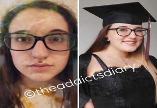 43 Before And After Transformations Of Drug Addicts - Ftw Gallery ...