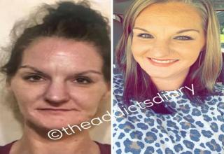 43 Before And After Transformations Of Drug Addicts - Ftw Gallery ...