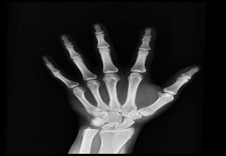 30 Disturbing Facts About The Human Body - Wtf Gallery | eBaum's World