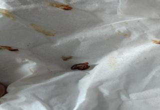 21 Disgusting Pics That Are Also Super Satisfying - Funny Gallery ...