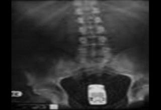 21 Real Crazy X-Rays - Ouch Gallery | eBaum's World