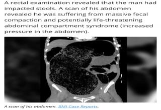 The Story Of The Real Life Randy Marsh And His Colossal Poo - Ouch ...