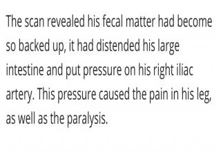 The Story Of The Real Life Randy Marsh And His Colossal Poo - Ouch ...