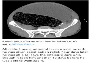 The Story Of The Real Life Randy Marsh And His Colossal Poo - Ouch ...
