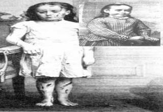 12 Disturbing Historical Pics - Creepy Gallery | eBaum's World